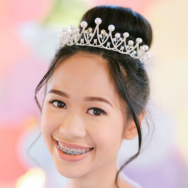 How Do Braces Do What They Do? – Markham ON | Markham Orthodontic Specialty